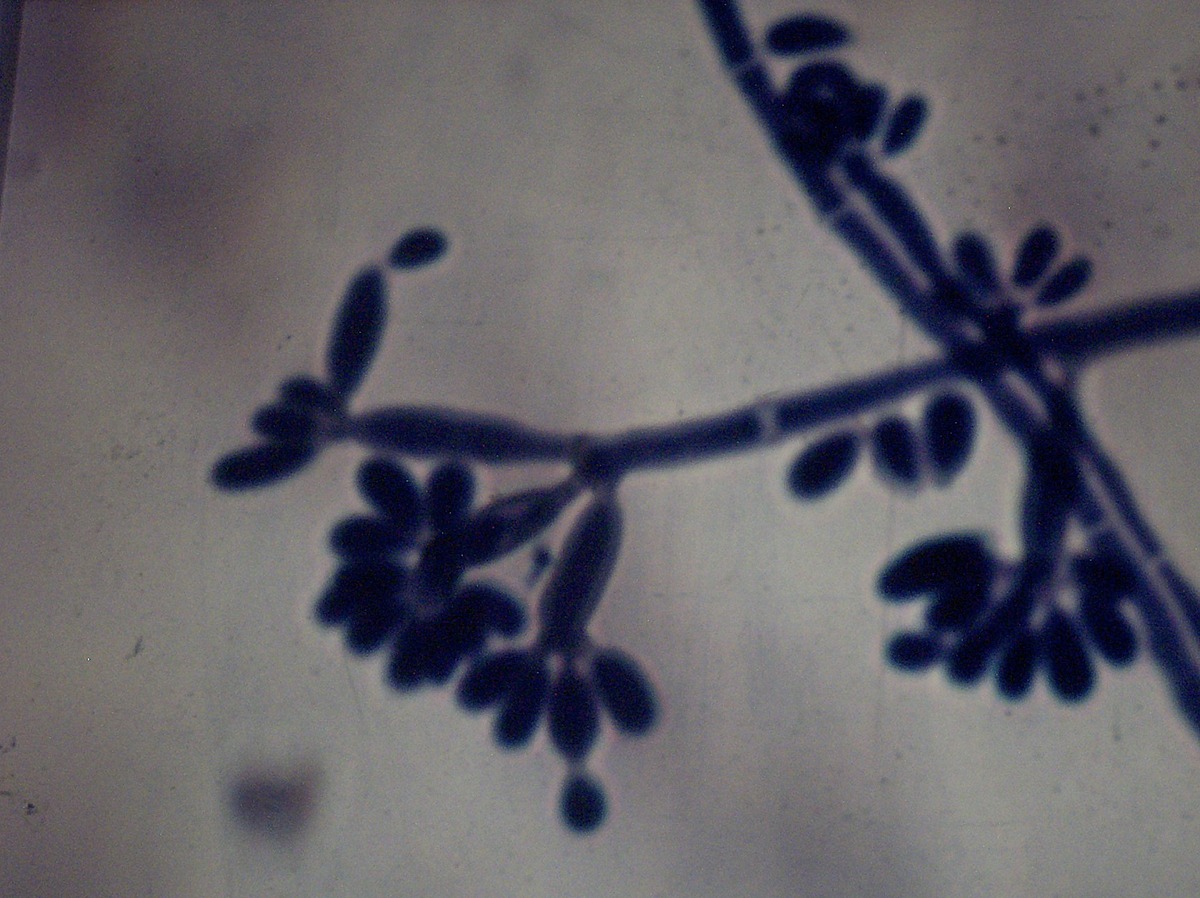 Fonsecaea | Natural Atlas