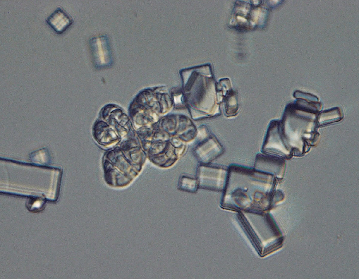 Wallemiomycetes | Natural Atlas