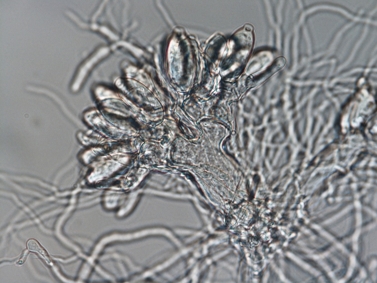 Chytridiomycota | Natural Atlas